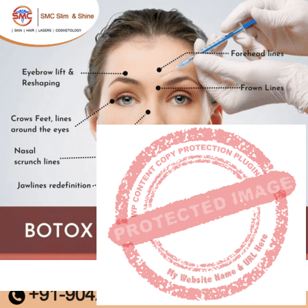 Botox Treatment in Anna Nagar